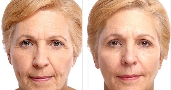 Workouts For The Face And Neck For Spectacular Anti-Aging Skin Care: A ...