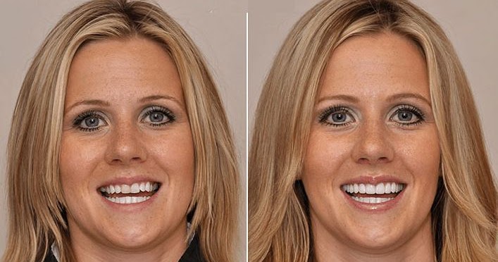 MedFriendly Medical Blog: Get a confident smile with bite correction ...