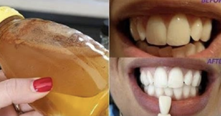 Haz gárgaras con este simple ingrediente y blanqueas tus dientes. - Lo ...