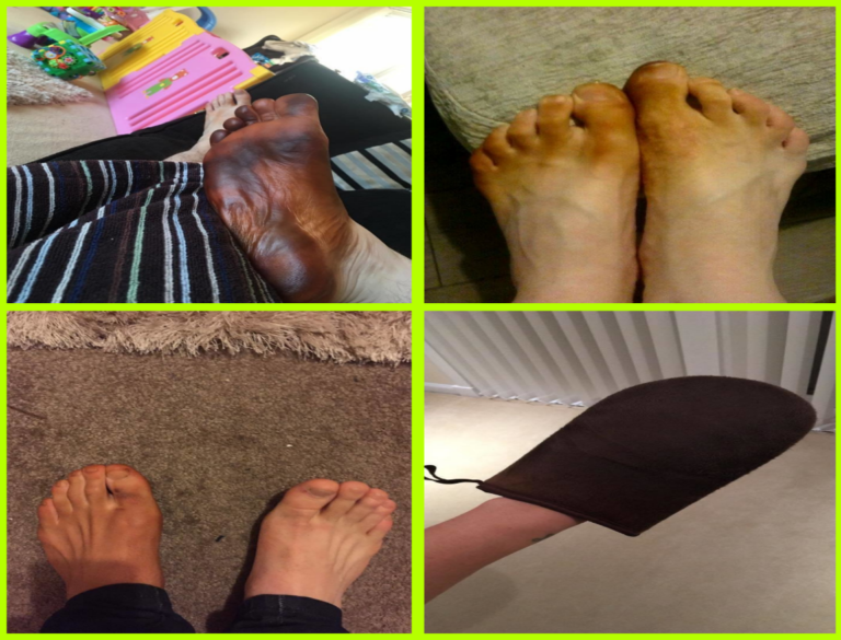 He Woke up With a Brown Foot and Every Guy Needs To Know Why? - Food ...