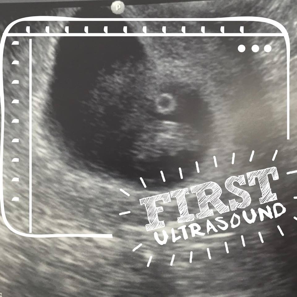 BABY FOURNIER COMING SOON : BUMPDATE 12 WEEKS - a fournier life