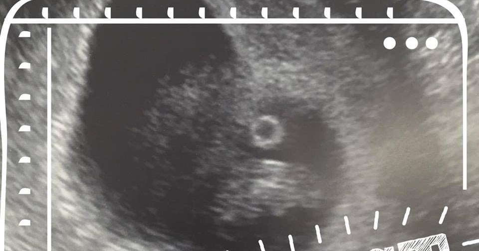 BABY FOURNIER COMING SOON : BUMPDATE 12 WEEKS - a fournier life