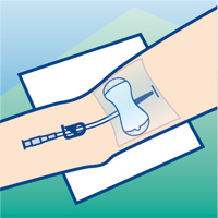 Gestion d'un cathéter MidLine | Récap' IDE