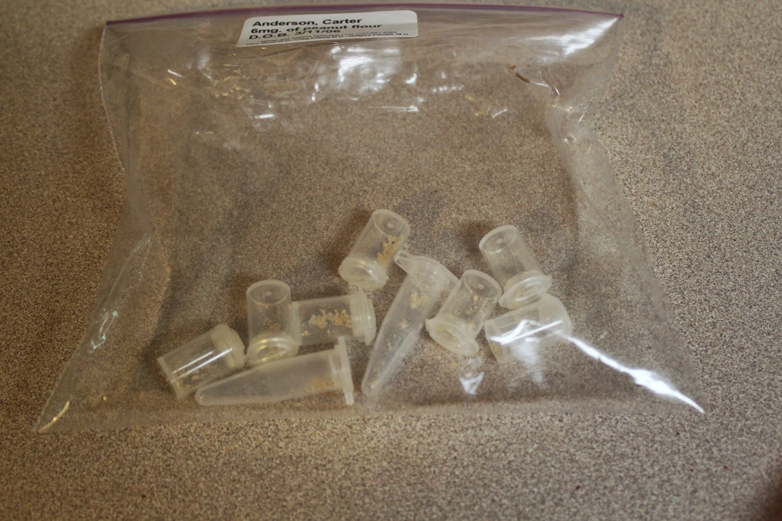 Courageous Carter: Starting Peanut OIT (Oral Immunotherapy)