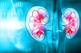 Judy's kidney disease clinics: Stade 5 Insuffisance rénale chronique (IRC)