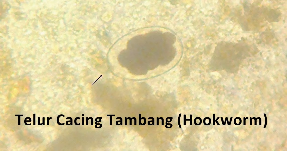 Rizqi Murtafi'ah: Pemeriksaan Telur Cacing Dengan Metode Pengapungan ...