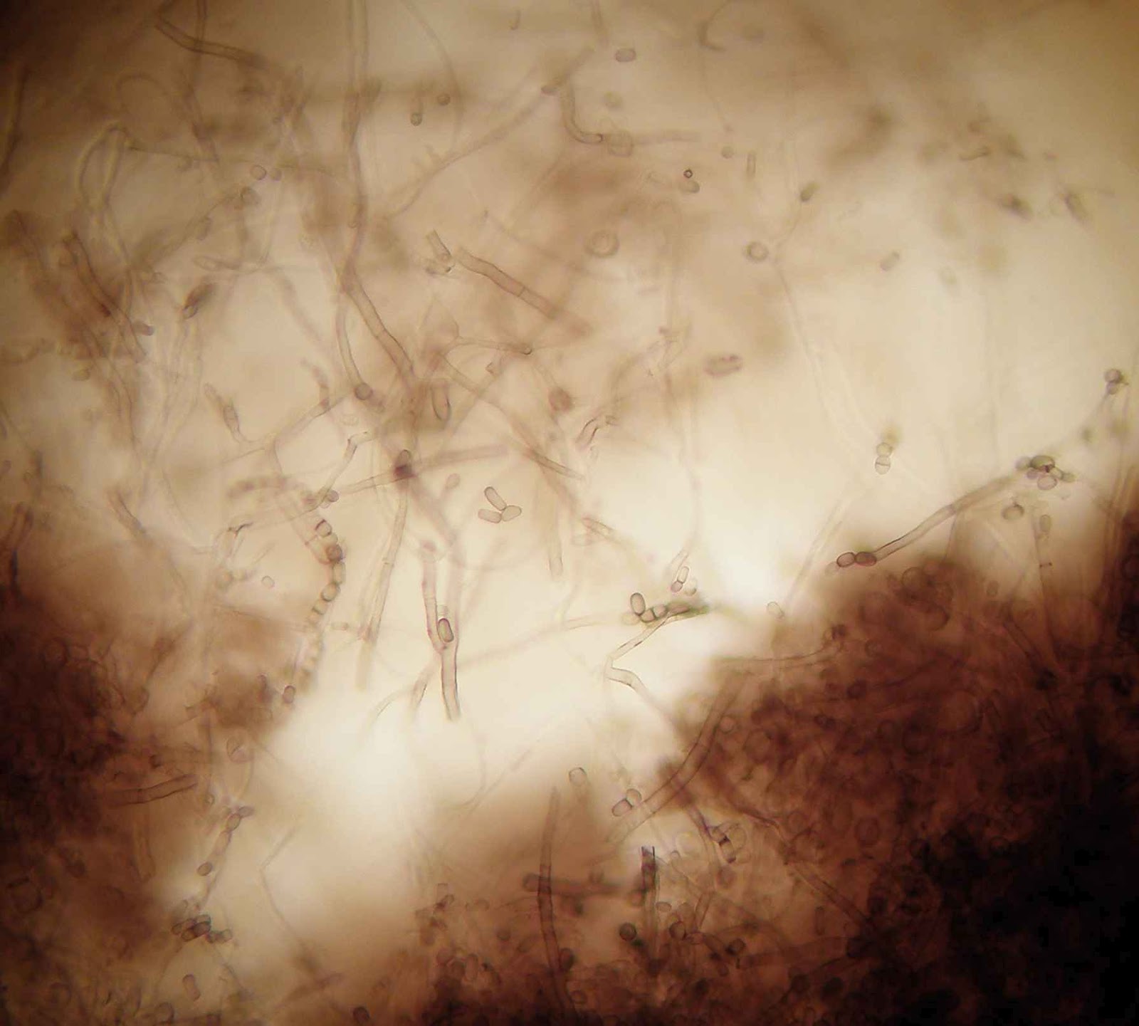 ATLAS MICOLOGIA: SCYTALIDIUM DIMIDIATUM (Neoscytalidium dimidiatum)