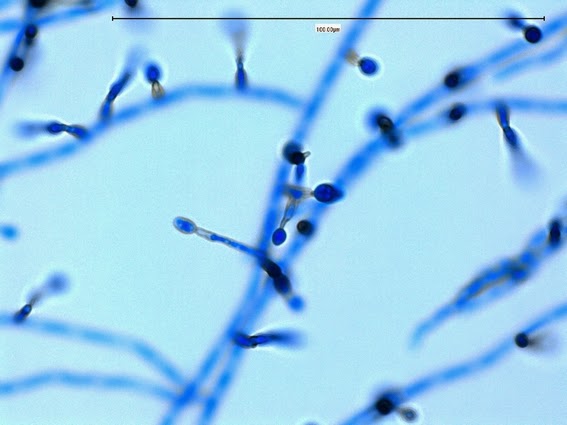 Fun With Microbiology (What's Buggin' You?): Ochroconis species