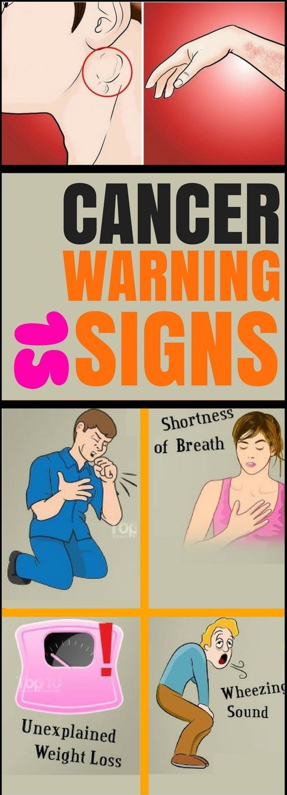 Here Are 15 Cancer Warning Signs People Assume Aren’t Dangerous Until ...