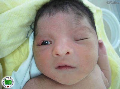 Dr. Frank Cajina Gómez: Atlas de Defectos Congénitos HECAM