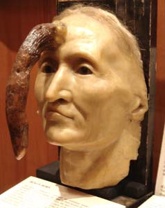 MedFriendly Medical Blog: Bizarre Images of Cutaneous Horns