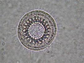 PARASIT & PENYAKIT IKAN : Trichodina sp.