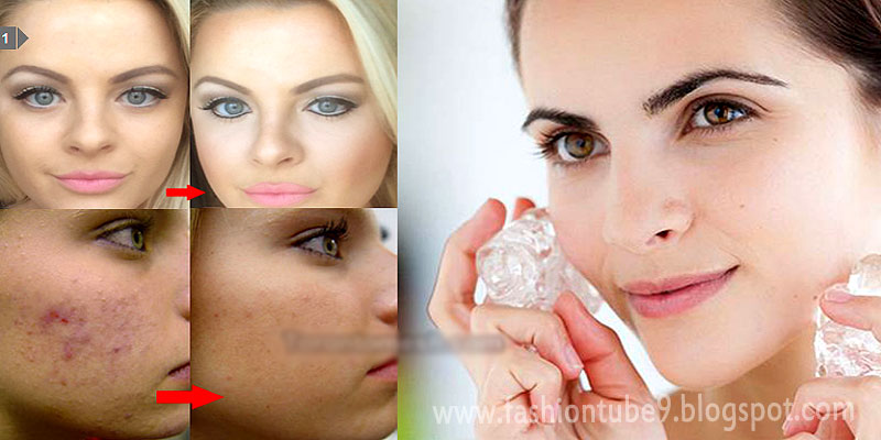 5 Ways Ice Can Improve Your Skin Health, You Must Try #5 - The Stylish Life