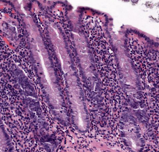 MoyinAdesanyaBiol 3500: The Human Appendix: My Favorite Organ: The ...