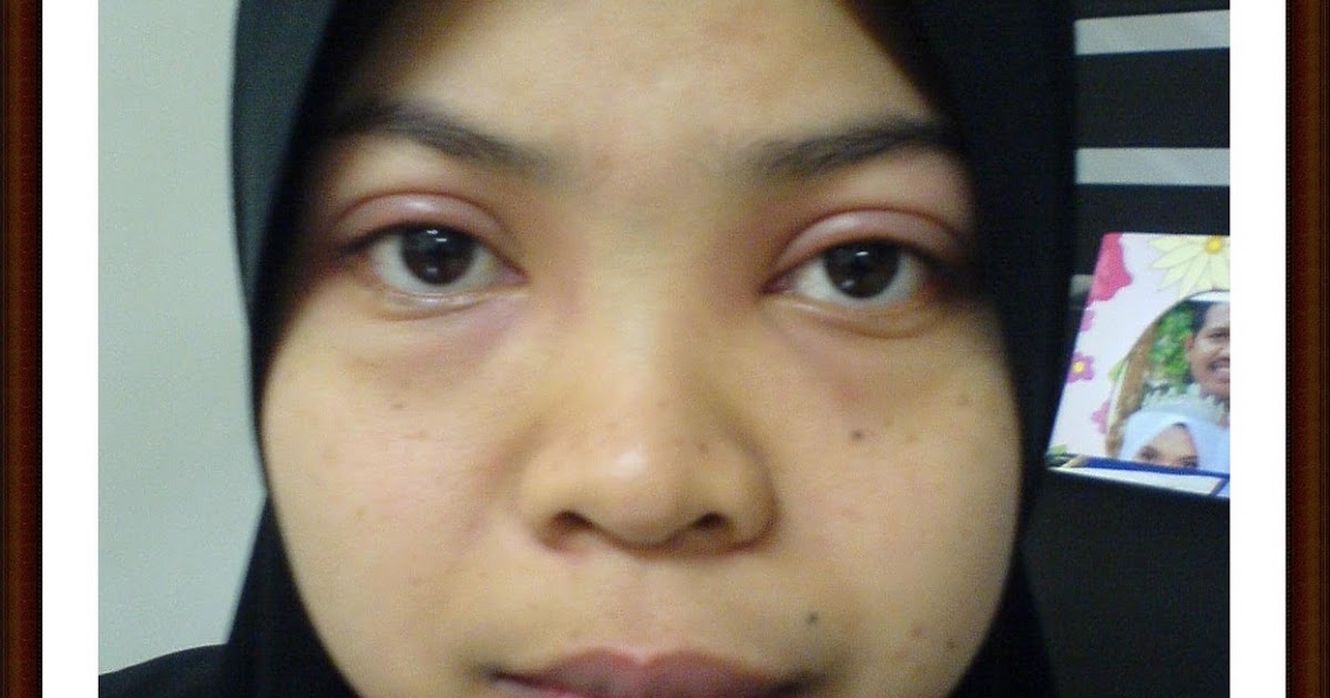 ~CoReTaN KeHiDuPaN~: MuKa BenGkAk YaNg CoMeL.