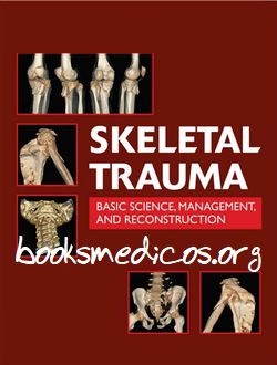 trauma | booksmedicos