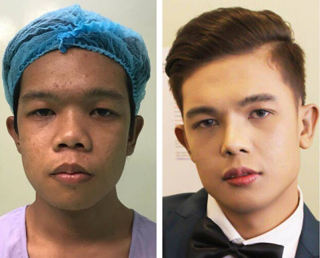 Expired na nga ba ang RETOKE ni Xander Ford? - news