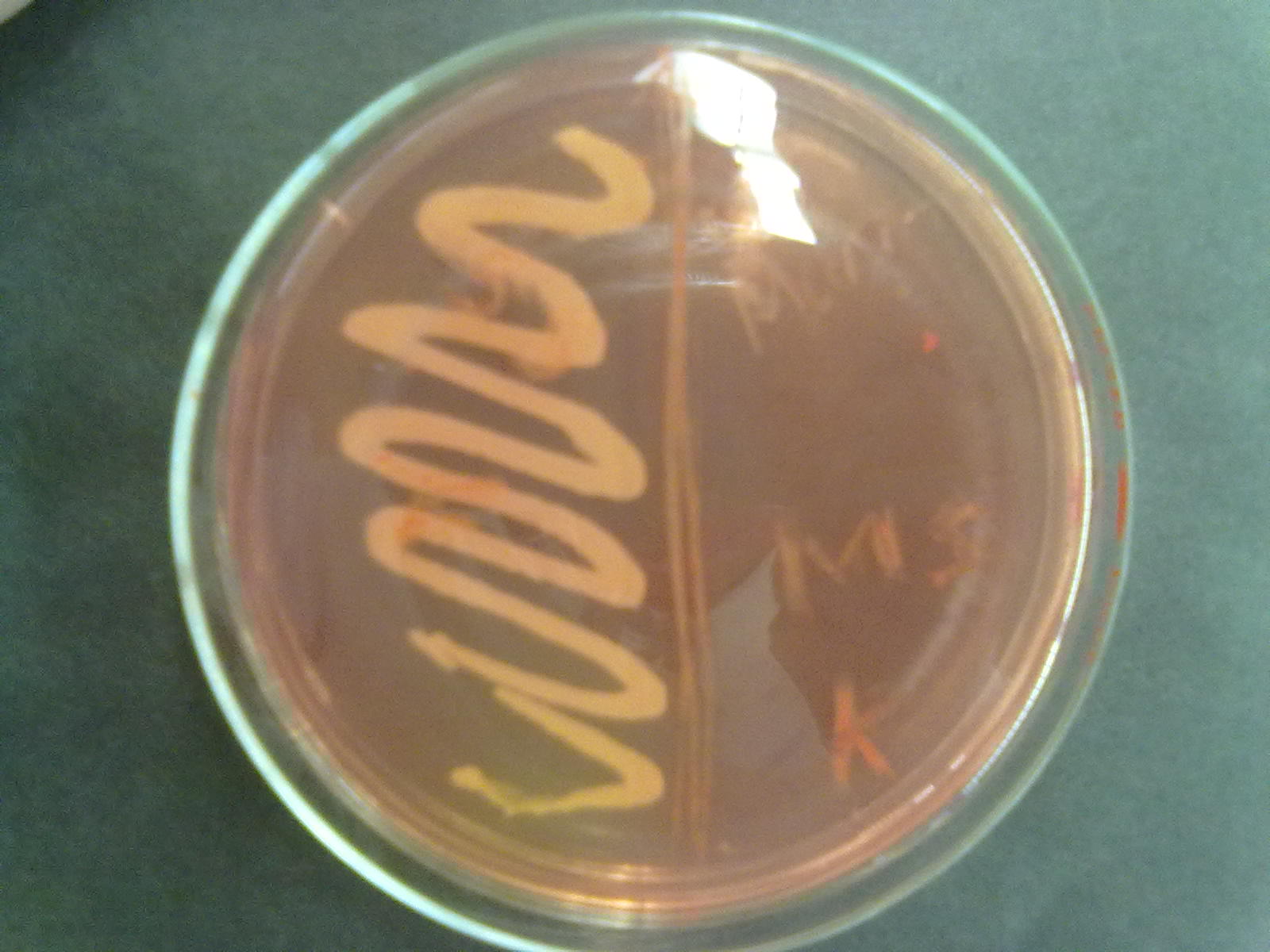 Samantha and Sarah's Microbiology Lab Journal: Results of Differential ...