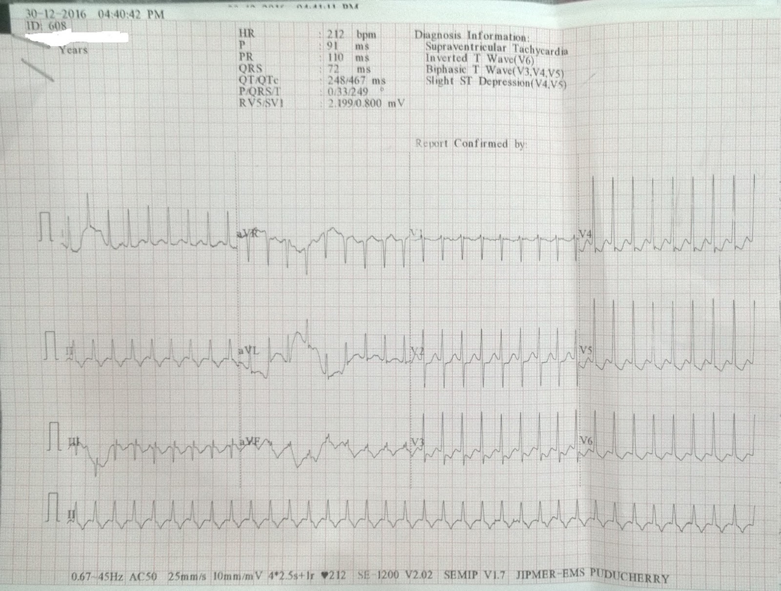 Cardiology window: ECG WPW syndrome