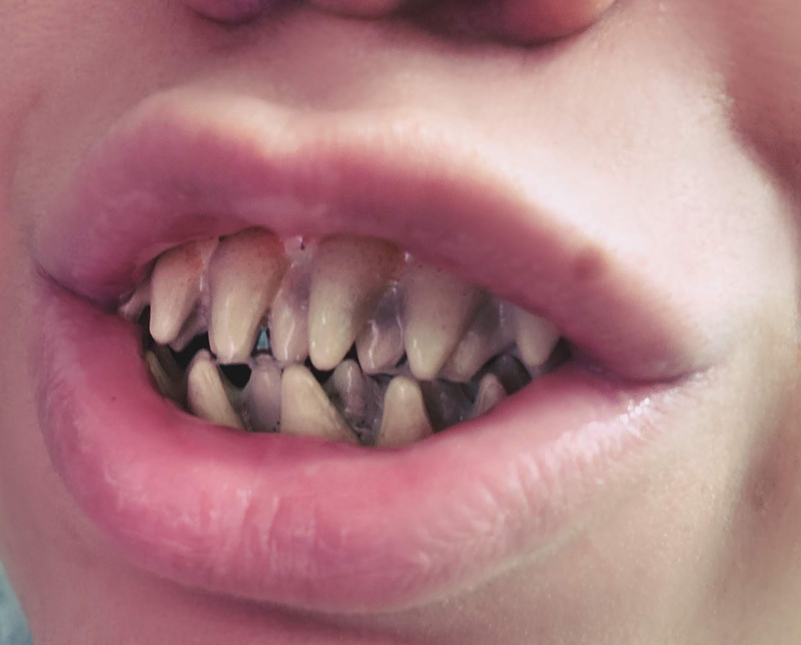 ĦΔŇŇΔβΔŁ ΜΔŘƗ€: Bitemares Horror Teeth "Souleater" Showcase/Review ...