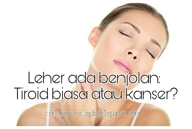 Leher ada benjolan: Tiroid biasa atau kanser? - Nota Cikla