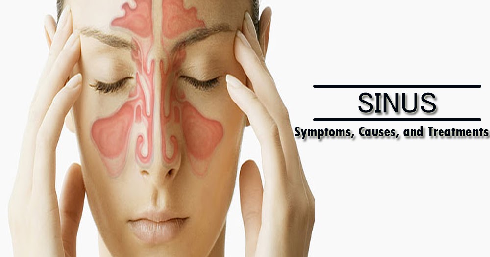Sinus Symptoms Causes And Its Treatments ~ Free Online Chat With