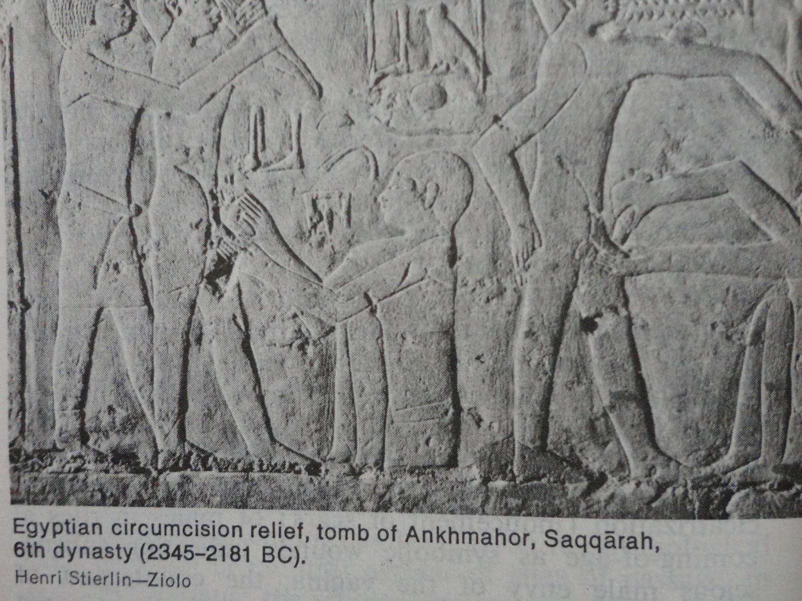 Historiographic: CIRCUMCISION - 4000 YEARS AGO