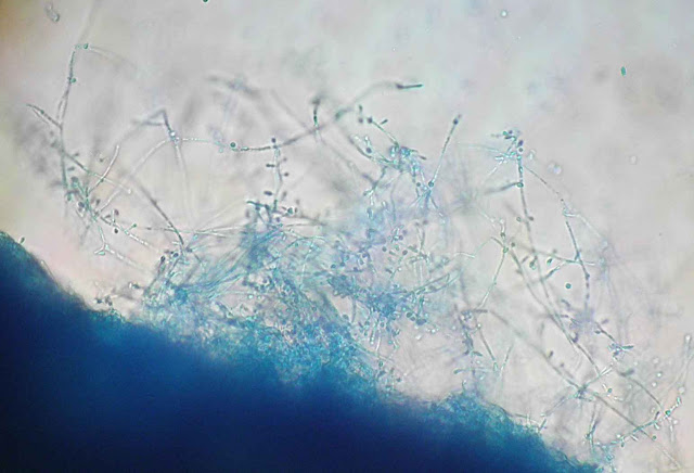 ATLAS MICOLOGIA: TRICHOPHYTON INTERDIGITALE
