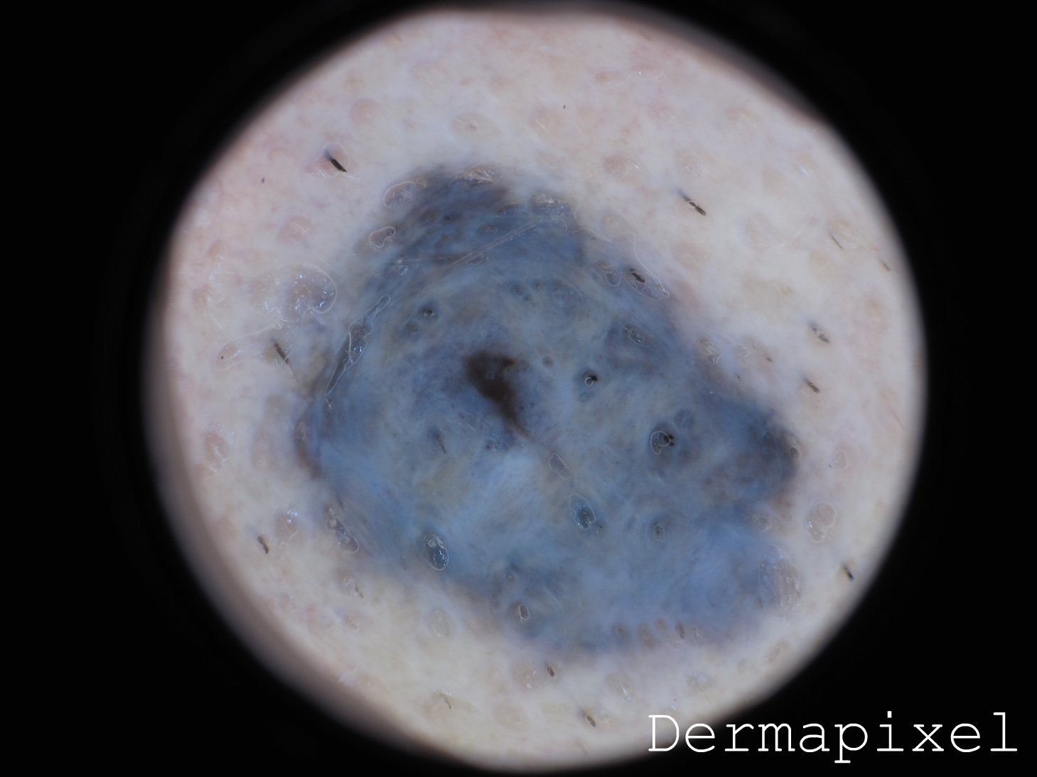 Dermapixel: enero 2013