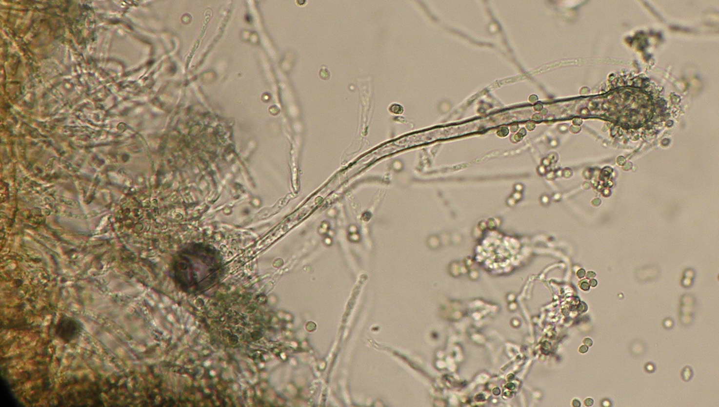 ATLAS MICOLOGIA: ASPERGILLUS GLAUCUS