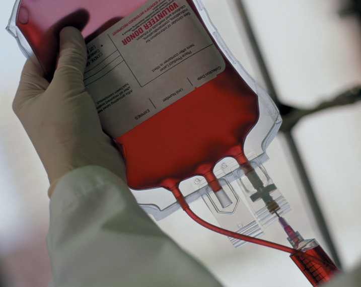 OMNISCIENCE: New Discovery-Blood Processing Machine.