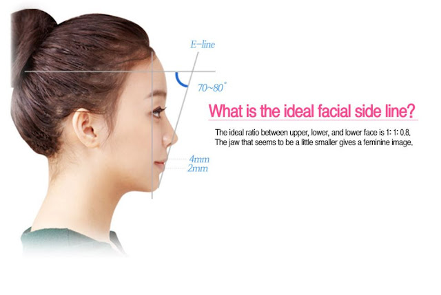 What is Faceline’s ASO (protruding mouth) Surgery?