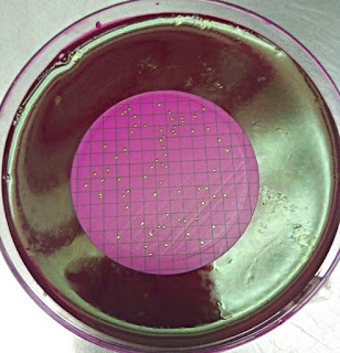 Membrane Filter Technique | Membrane Filtration Method (Microbes ...