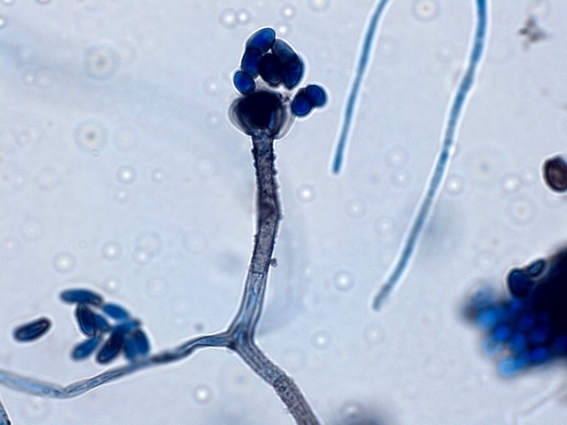 Fun With Microbiology (What's Buggin' You?): Stachybotrys species