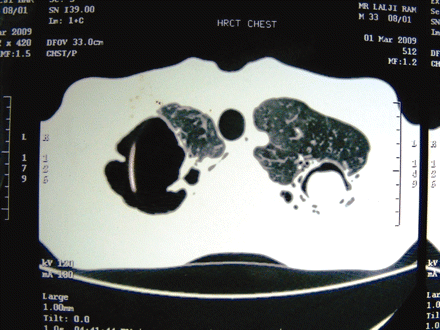 Medical Cases by Abhishek's mind