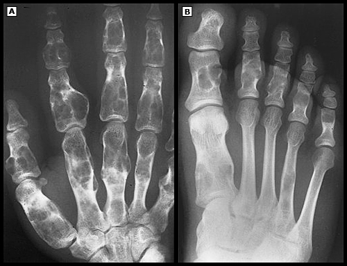 EL RINCÓN DE LA MEDICINA INTERNA. juanpedromacaluso@yahoo.com.ar ...