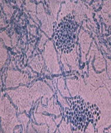 Micosis Humana: Tipos de Dermatomicosis