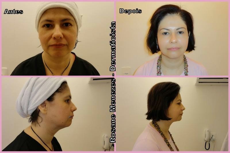 Rosane Menezes, Saúde e beleza.