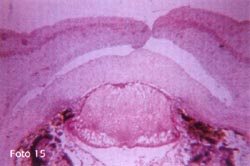 OFTALMOLOGÍA...............LUZ PARA TU CONOCIMIENTO: Embriología del ...