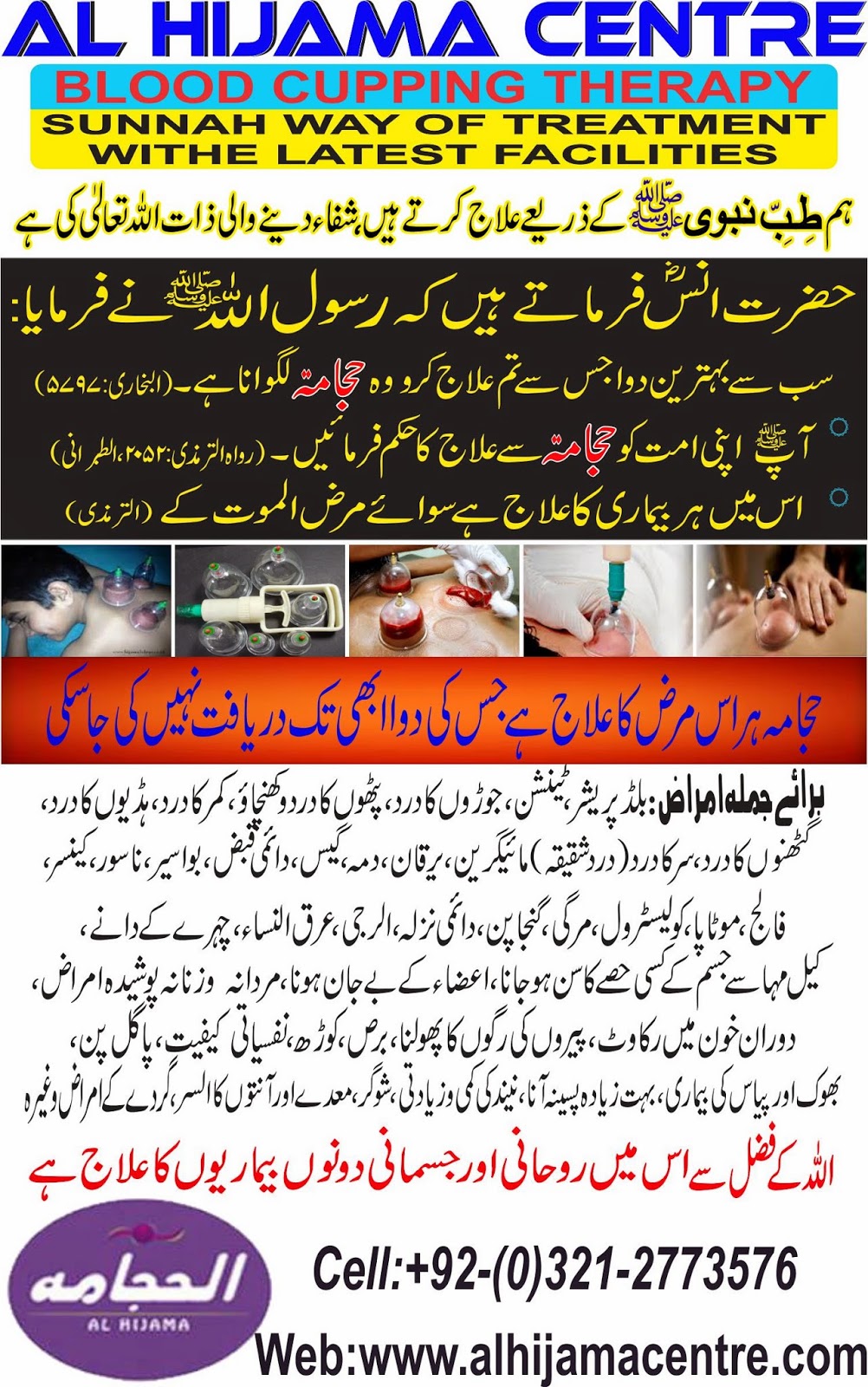 Al Hijama Centre: WHAT IS HIJAMA DESCRIBE WITH AHADIS E NABAWI