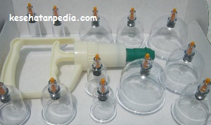 Mengenal dan Mengetahui Manfaat Terapi Bekam - kesehatanpedia