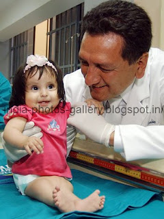 INDIA PHOTO GALLERY: Extremely rare birth defects