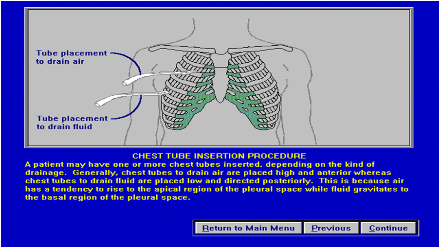 4m4lk d'l45t4: Prosedur Pemasangan dan Pencabutan WSD