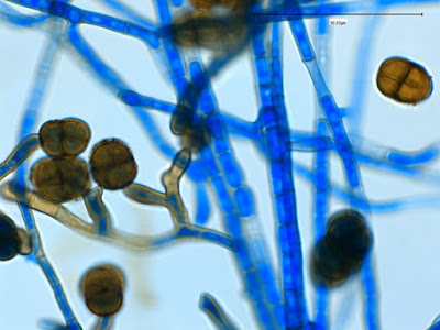 Fun With Microbiology (What's Buggin' You?): Stemphylium species