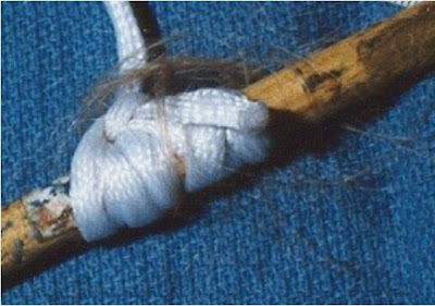 Solving the JonBenet Ramsey Case: Fantastic Theories - Part Deux