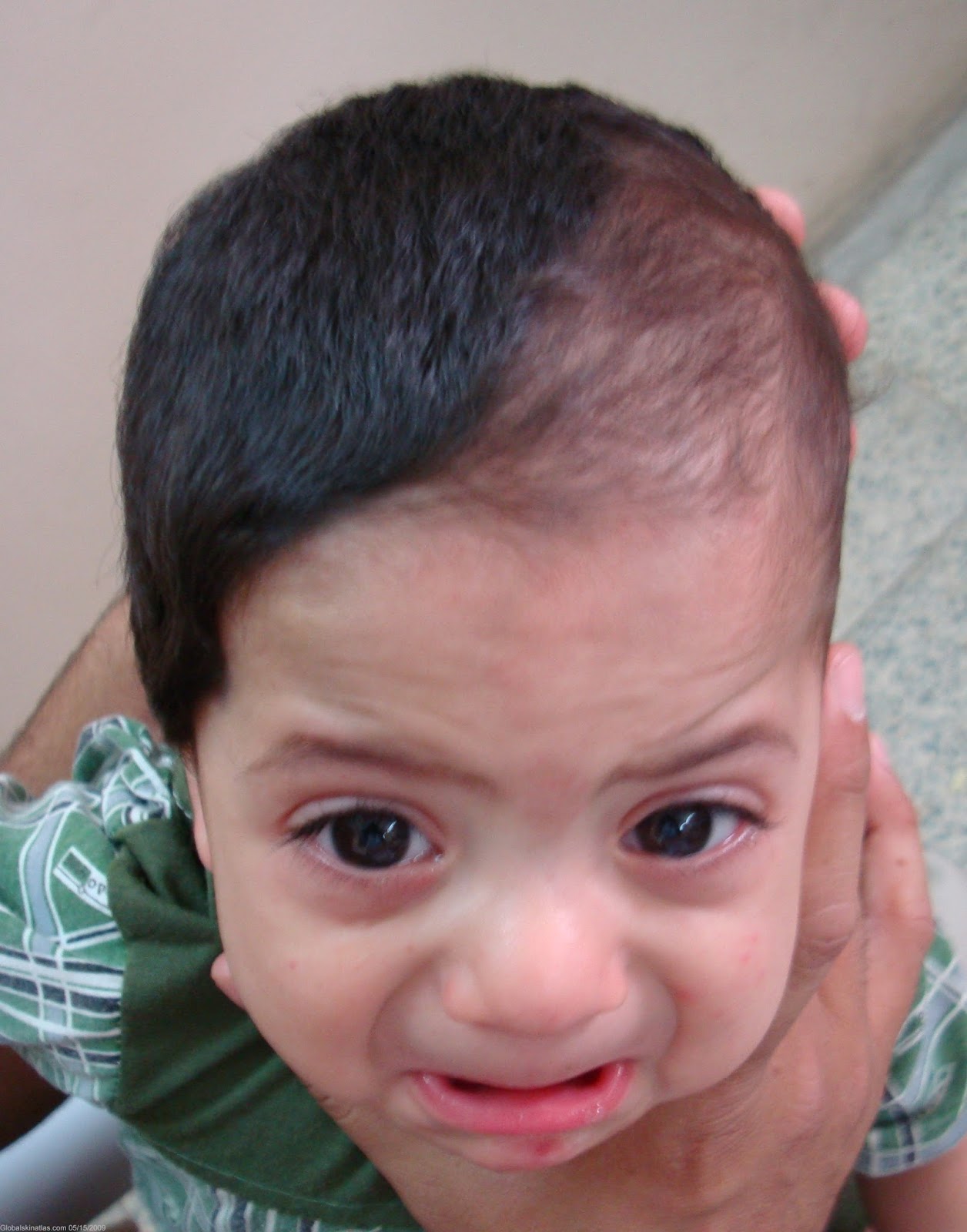 KING HSAN IV: Know your Symptoms!