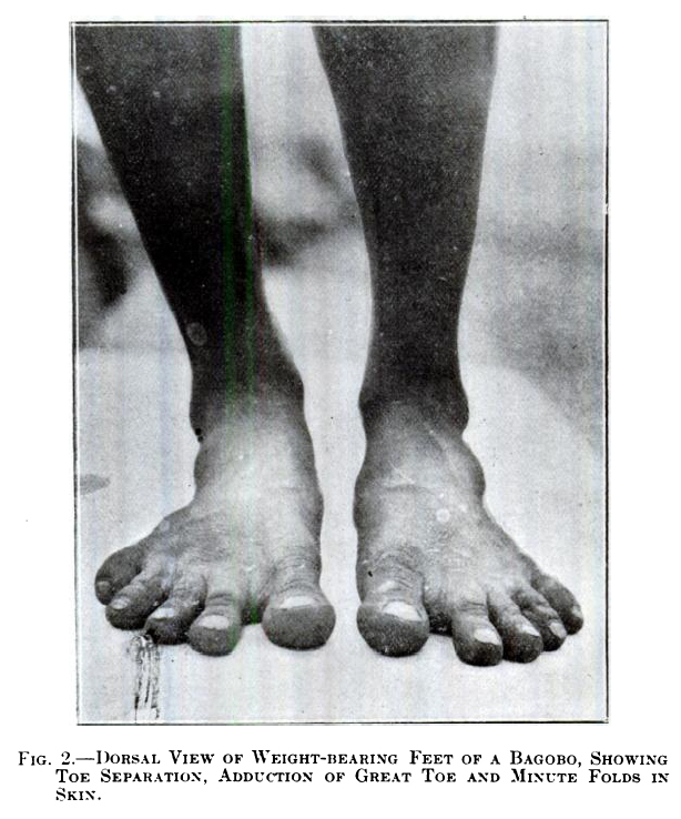 chooky fuzzbang: freaky toes