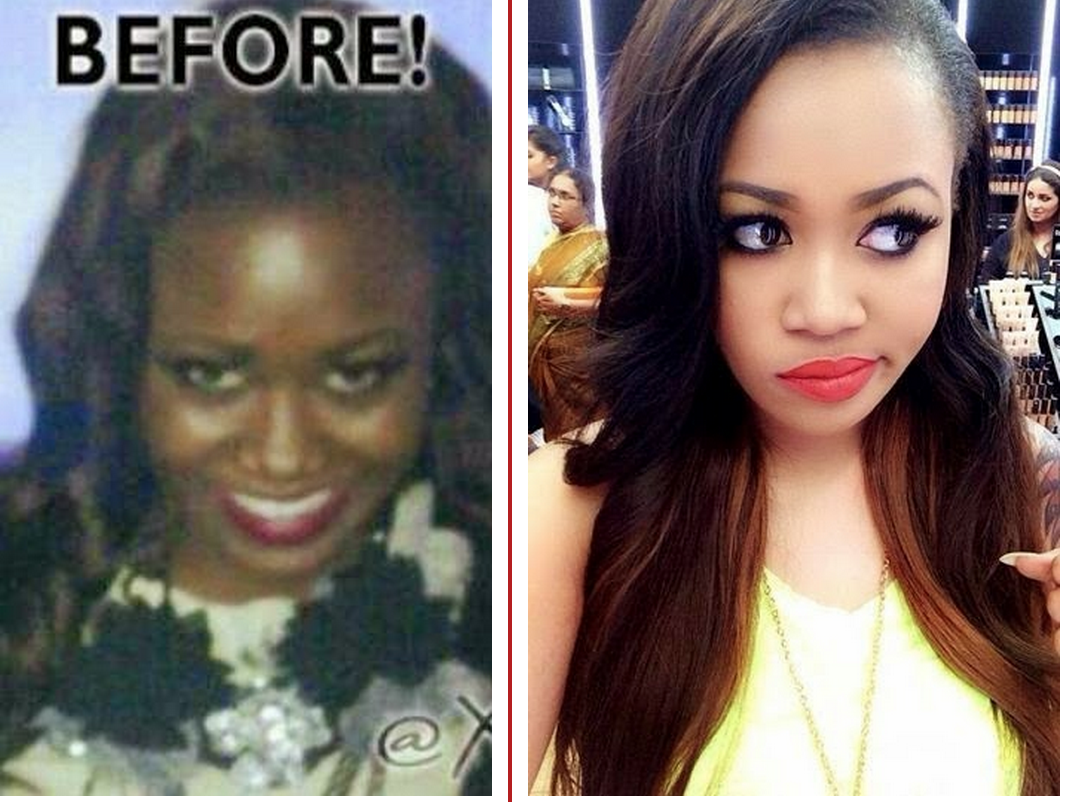 Must Read: Dangers of Skin Bleaching - Albrak Entertainments