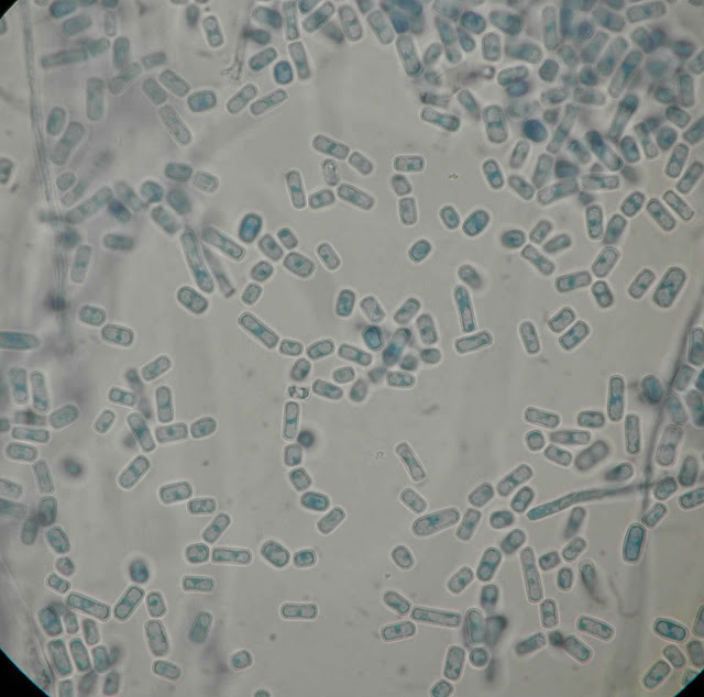 ATLAS MICOLOGIA: MAGNUSIOMYCES CAPITATUS