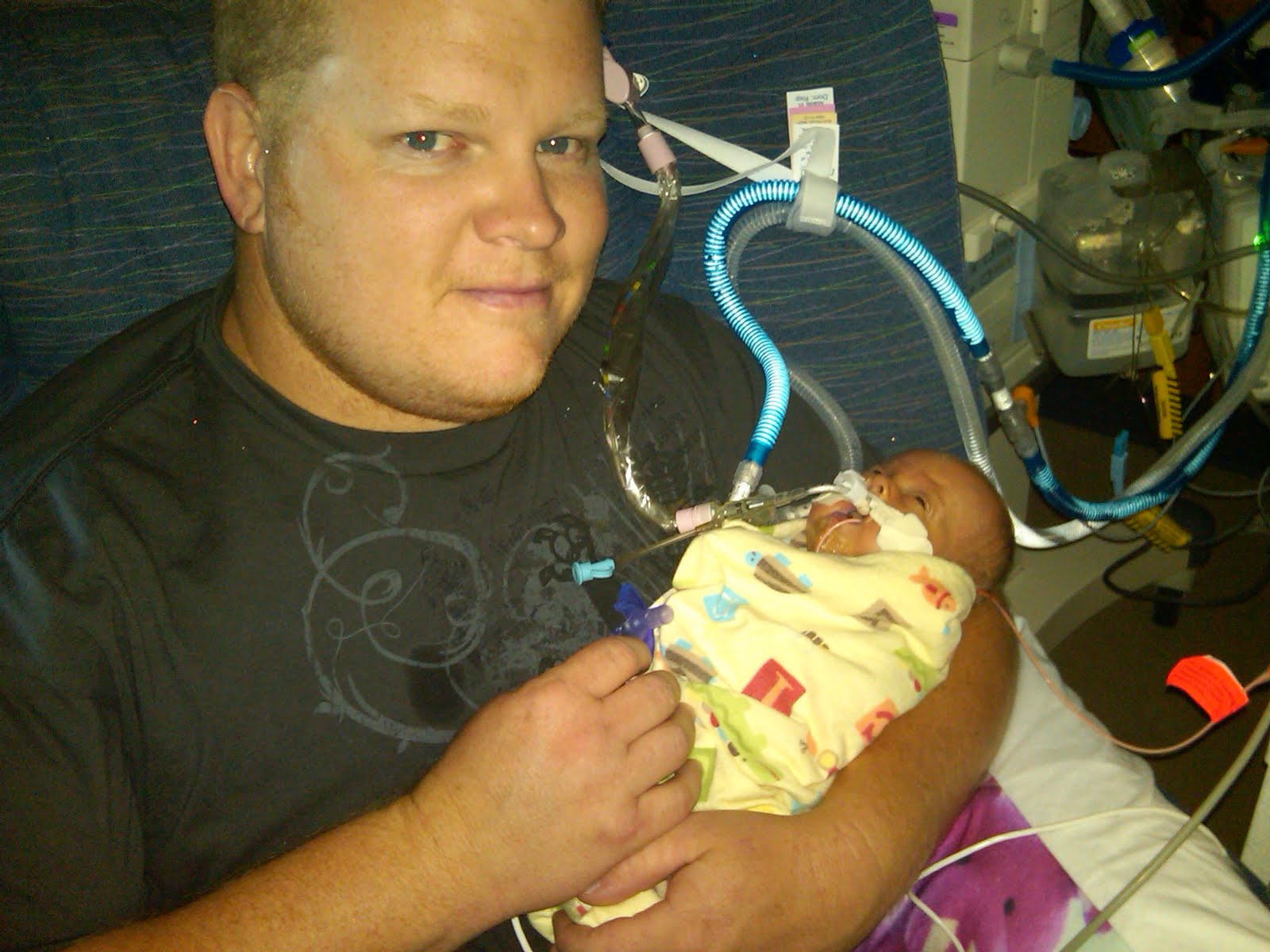 Bryce Alexander Moline: 24 Weeks, 1 day - Again